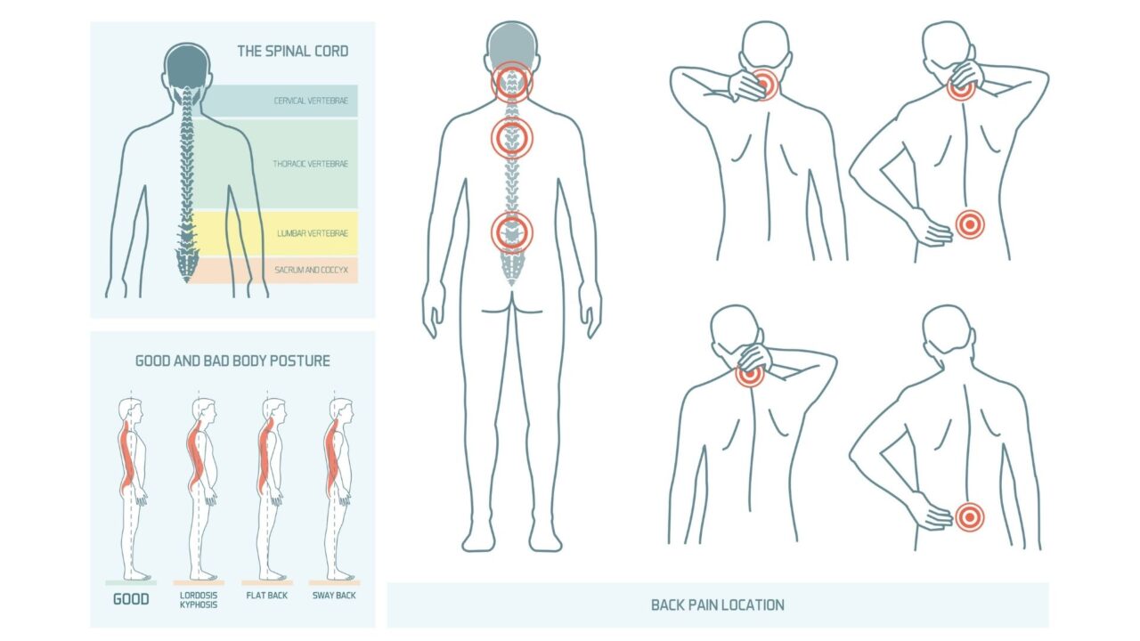 Surfers Back: Causes and Tips for Prevention - Surf Indonesia